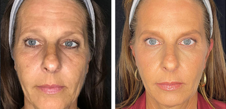 Med Spa in New Smyrna Beach | Med Spa NSB