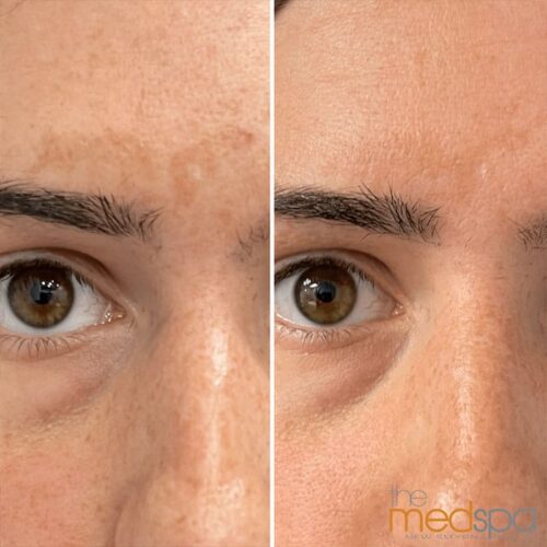 Pigment & Melasma Treatment New Smyrna Beach | The Med Spa